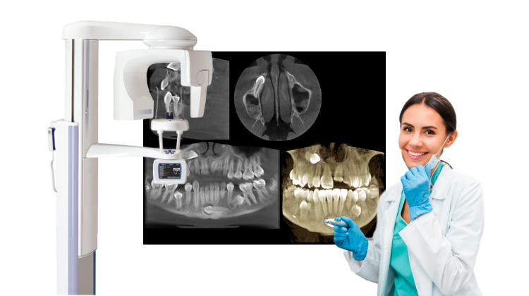 Benefits of Adding Dental Cone Beam to the General Dental Practice
